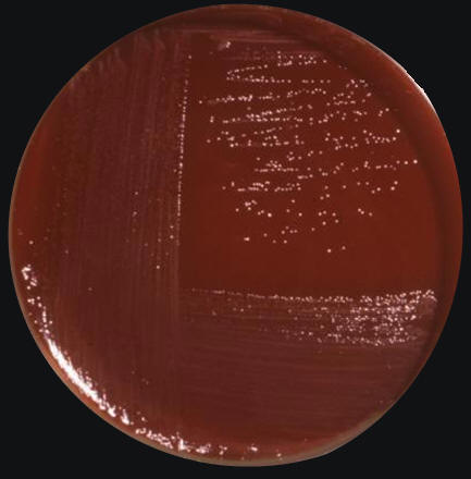 Lecture Notes in Medical Technology: Lecture #11: GRAM NEGATIVE BACILLI ...