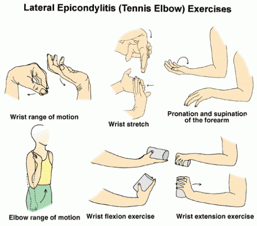 Exercise for tennis elbow pdf