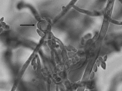 Visualization of Fusarium under Scanning Electron Microscope and ...