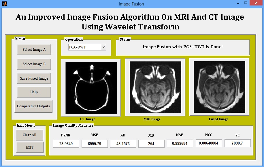 Image Fusion Algorithm On MRI And CT Image Using Wavelet Transform Full Matlab Project ...