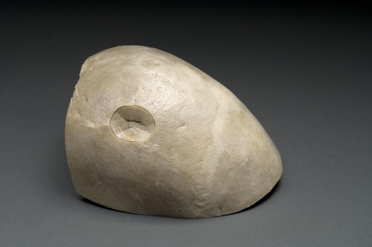 Ur Medstudy FREE Medical MCQs online: MCQ 39 'Fracture-ala-signature' is: