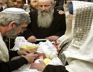 Una visión profunda del Judaísmo: Práctica #2: Brit Milá