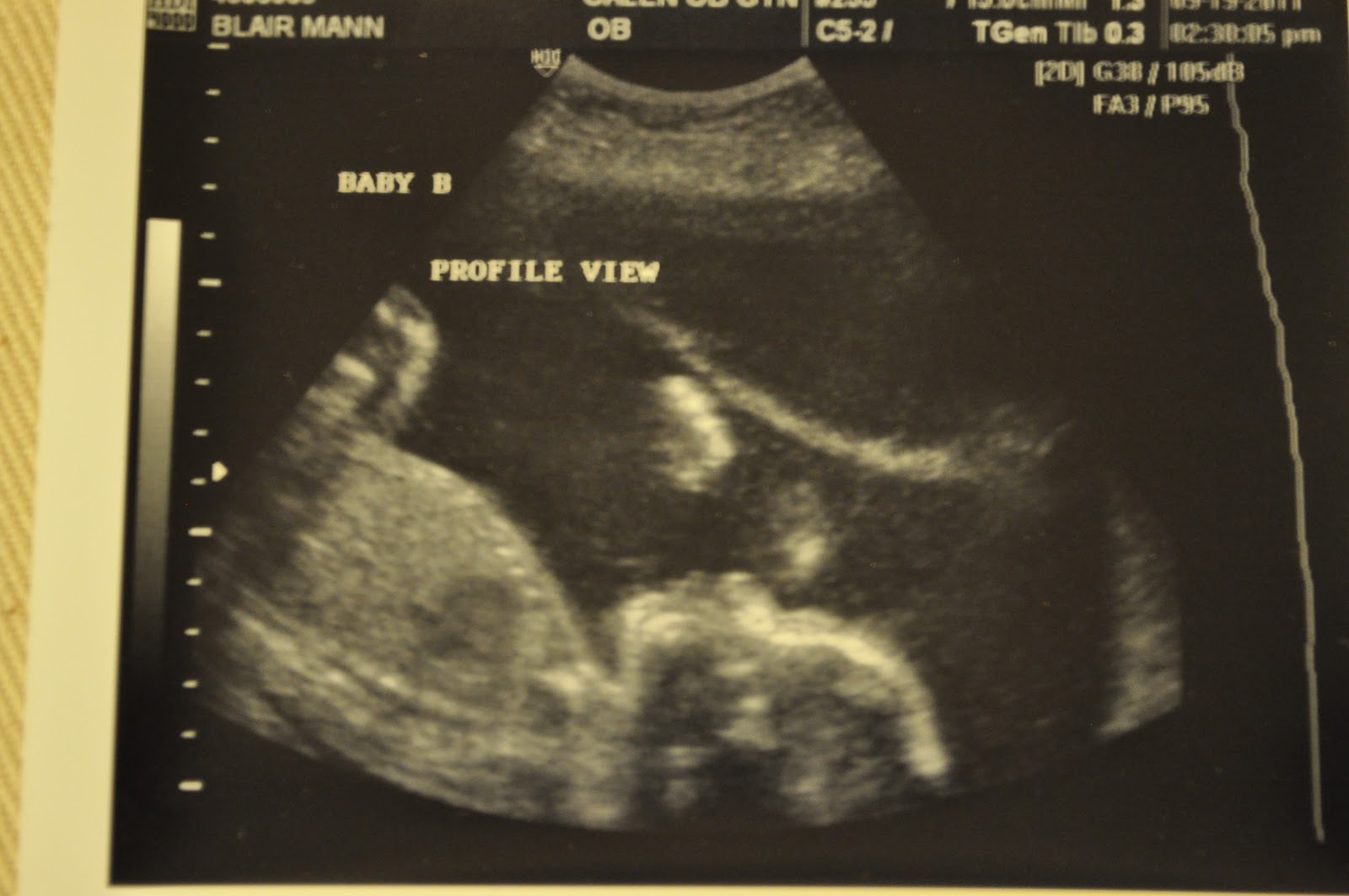 Little Mann Girls!!: 22 Weeks Ultrasounds