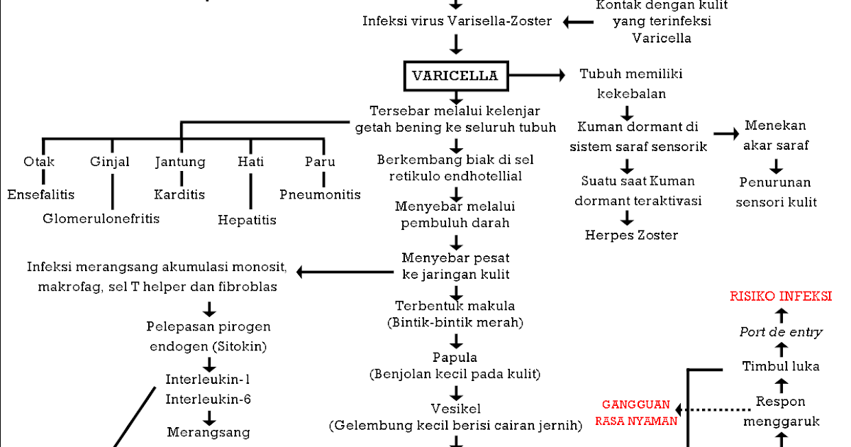 Pathway Varicella (Cacar Air)