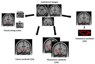 Brainmarkers.com: Comparison of structural MRI methodologies for ...