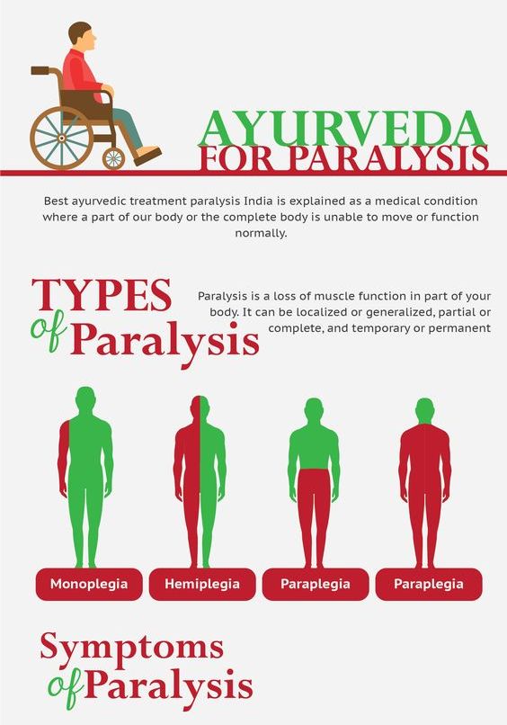 Parijatak: बेस्ट पक्षाघात आयुर्वेदिक उपचार भारत