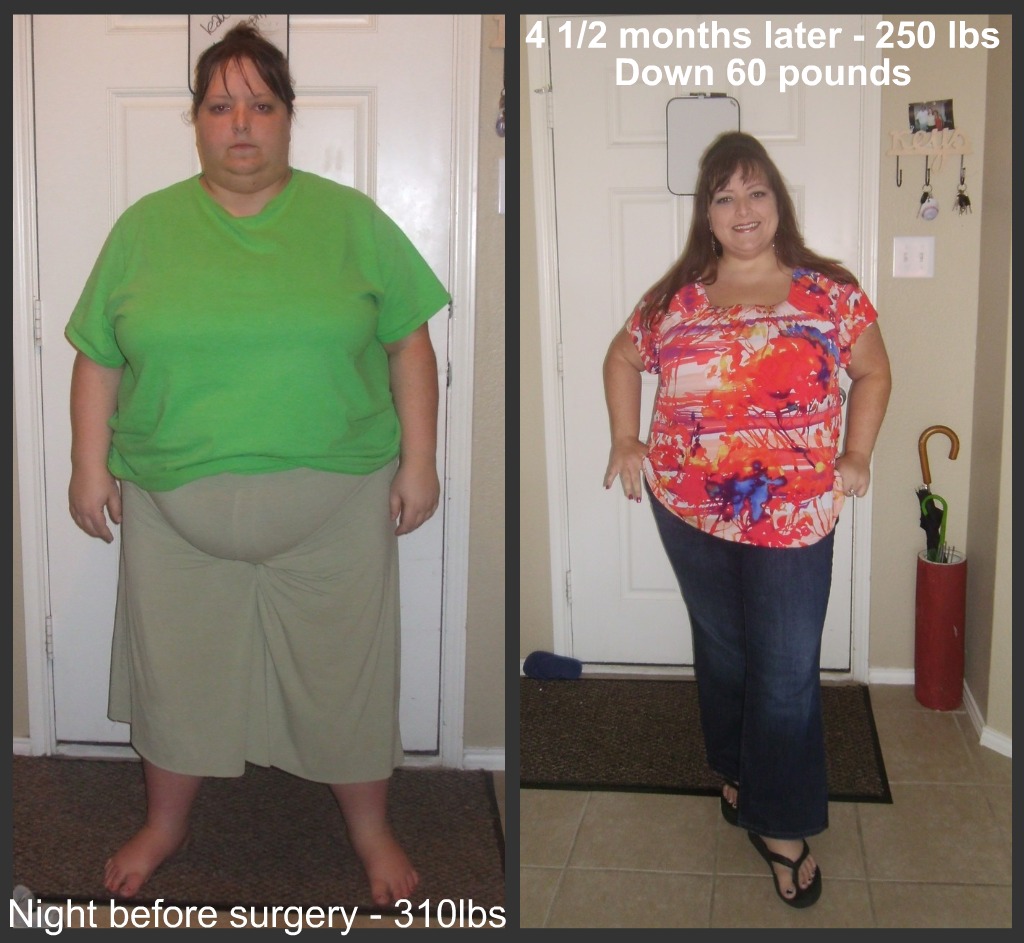 In Weigh Over my Head: new comparison pic! - 60 pounds lost since ...