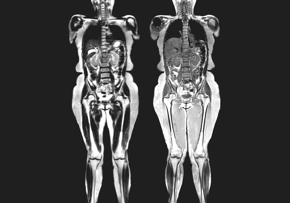 Full body CT Scan Full Body Cat Scan full-body-ct-scan-full-body-cat-scan