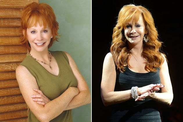 Reba McEntire Plastic Surgery