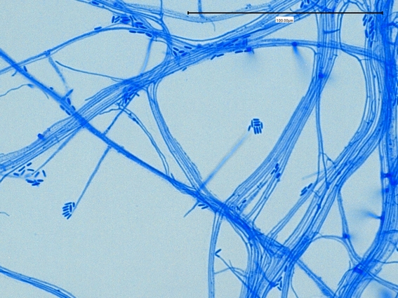 Fun With Microbiology (What's Buggin' You?): Sarocladium kiliense