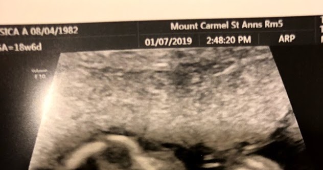 The Life of Caroline Mary: The 18-week Ultrasound