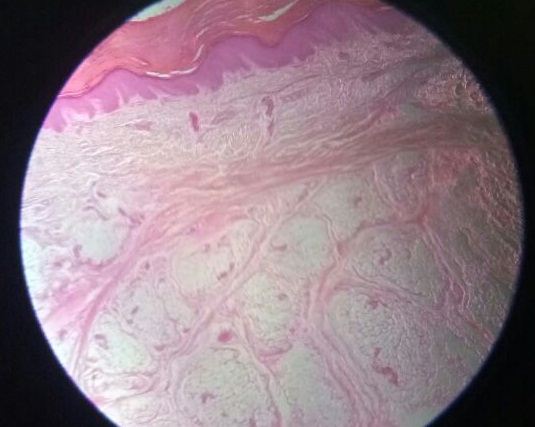 LAPORAN PRAKTIKUM JARINGAN EPITEL