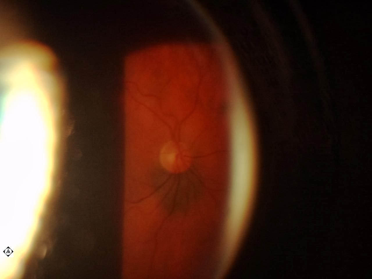 Sonoran Desert Eye Center: 2013