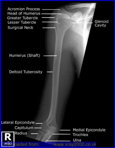 OS HUMERUS ~ RADIOLOGI BANK X-ray