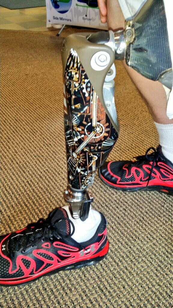 Prosthetic Medic: Stanford Speech and Steampunk Prosthetics