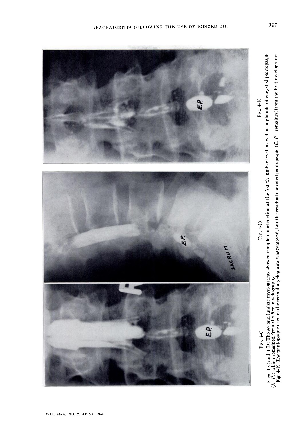 Myodil Killer: 7. Revue Patient Cases and Dog Test Results 1954