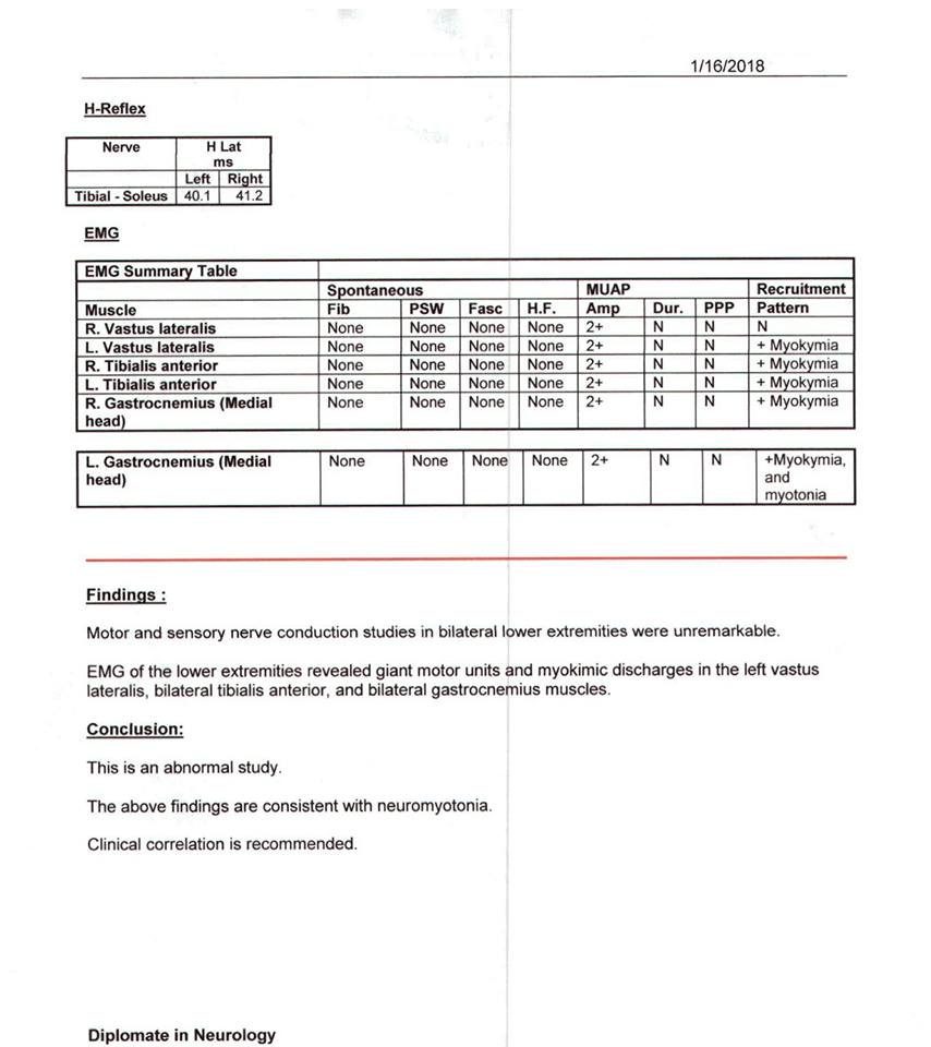 Neuromyotonia | Isaac's Syndrome | CFS | PNH | VGKC associated LE ...