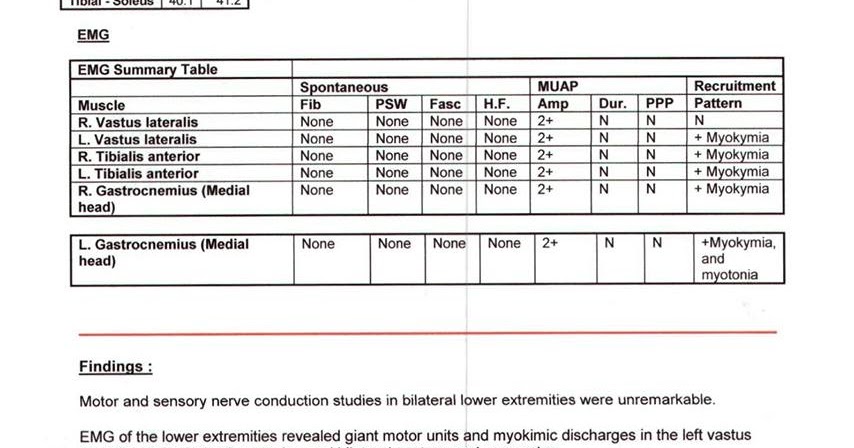 Neuromyotonia | Isaac's Syndrome | CFS | PNH | VGKC associated LE ...
