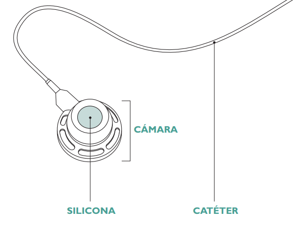 A punta de bisturí: Reservorio venoso subcutáneo