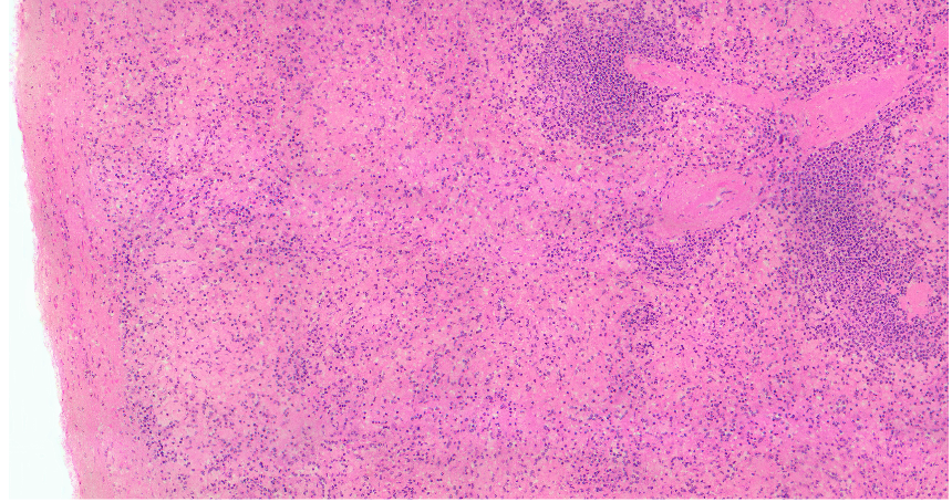 TP Histologie N° 2: la rate ~ TOP صحة