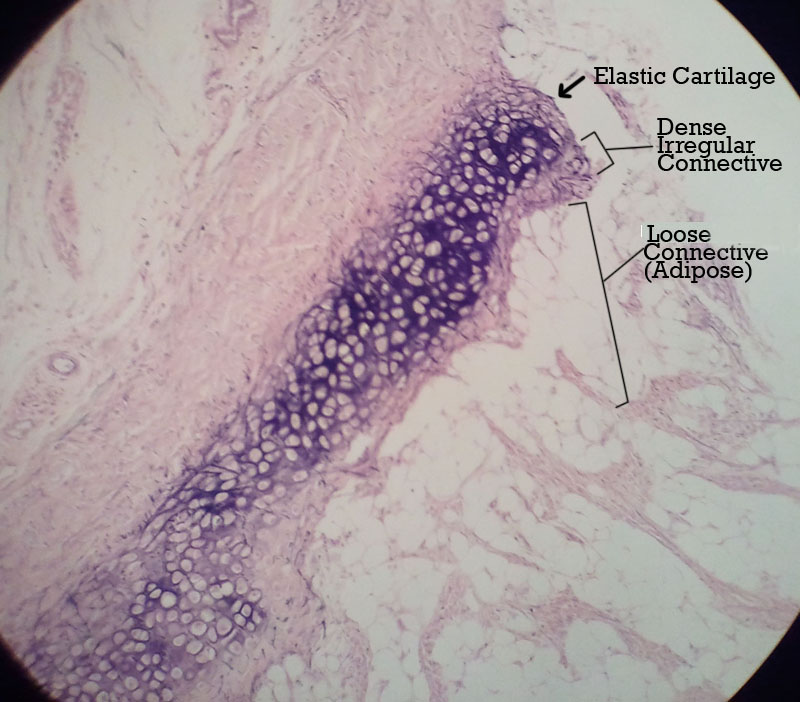 Duda's Epic Quest To Epicness: Epiglottis Histology