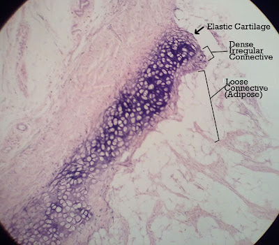 Duda's Epic Quest To Epicness: Epiglottis Histology