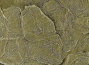 The Biological Mechanism Of Sunburn