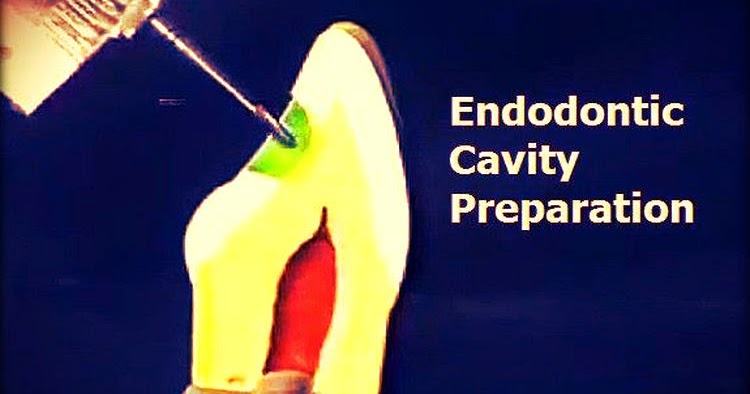 ENDODONTIC Cavity Preparation - University of Michigan - Odonto-Tv