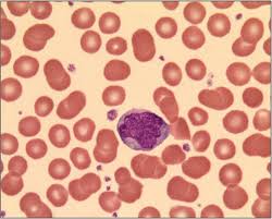 Analis Kesehatan: Sel Darah Putih (Leukosit)
