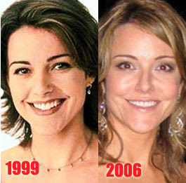 Christa Miller Plastic Surgery Before and After Nose Job, Breast ...