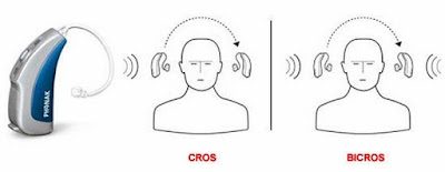 Cros Hearing Aid : Cros Hearing Aid Pros And Cons