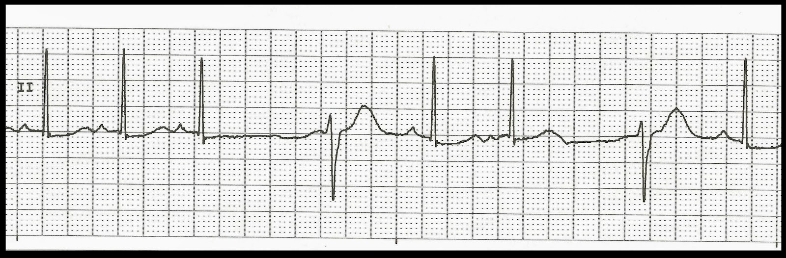 Practice EKG Rhythm Strips 224