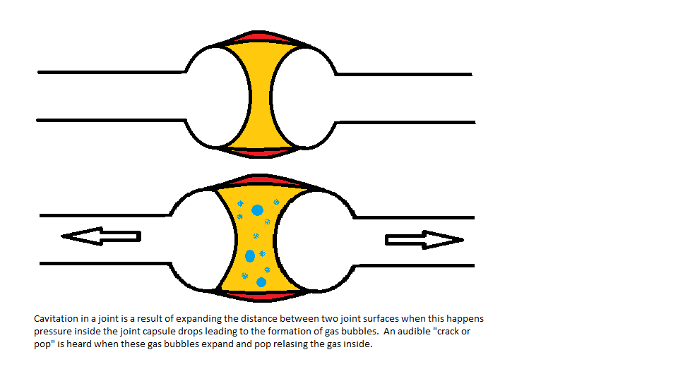 Schafer Chiropractic: STOP THE POP!