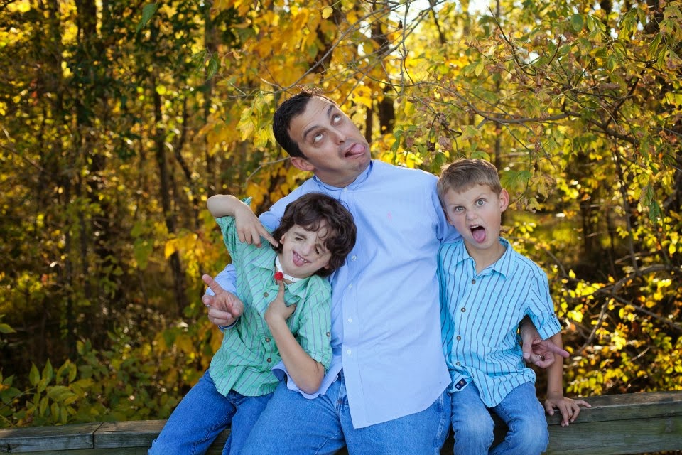 Treacher Collins Syndrome Nathaniel - Quotes Viral Update