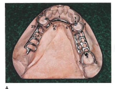 hiphoplife: Components of a removable partial denture