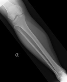 The Quest for Height: Grow Taller | Increase Height | Bone Size ...