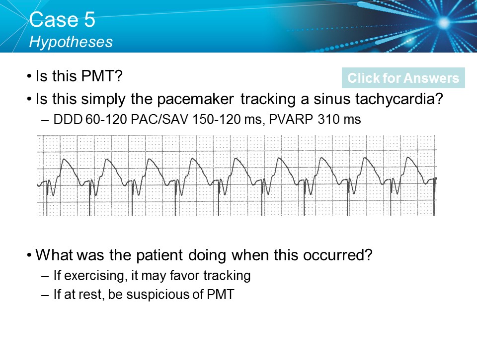 CVT Mohd Farid: Basic Pacemaker Troubleshooting Part II-Medtronic Academy