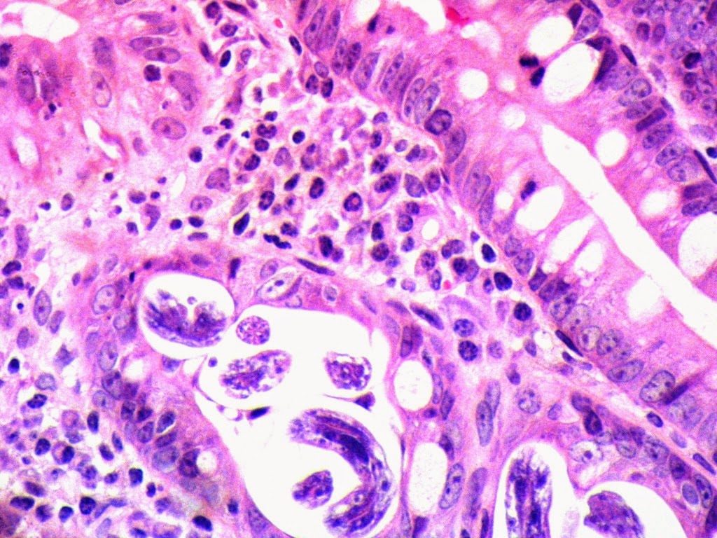 GASTROINTESTINAL AND LIVER HISTOLOGY PATHOLOGY ATLAS: DUODENUM ...