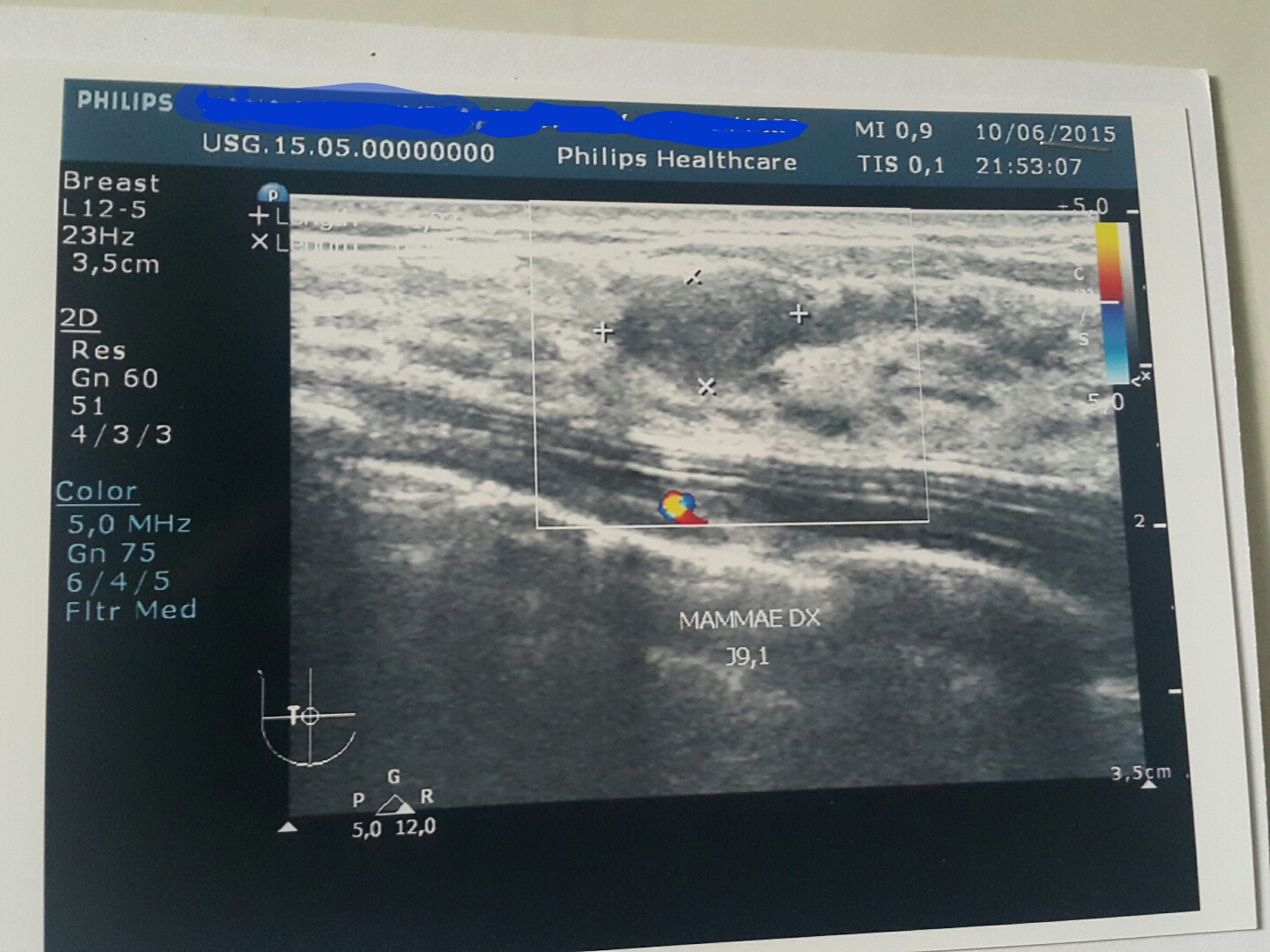 KATA PENA: Breast Cancer Awareness