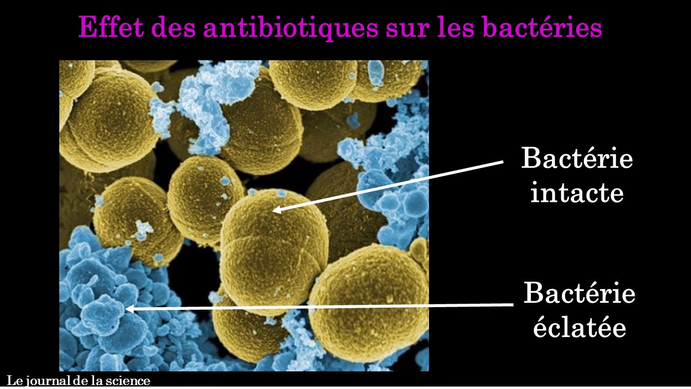Le labo d'Anissa - SVT: Chapitre 1 : La contamination par les micro ...