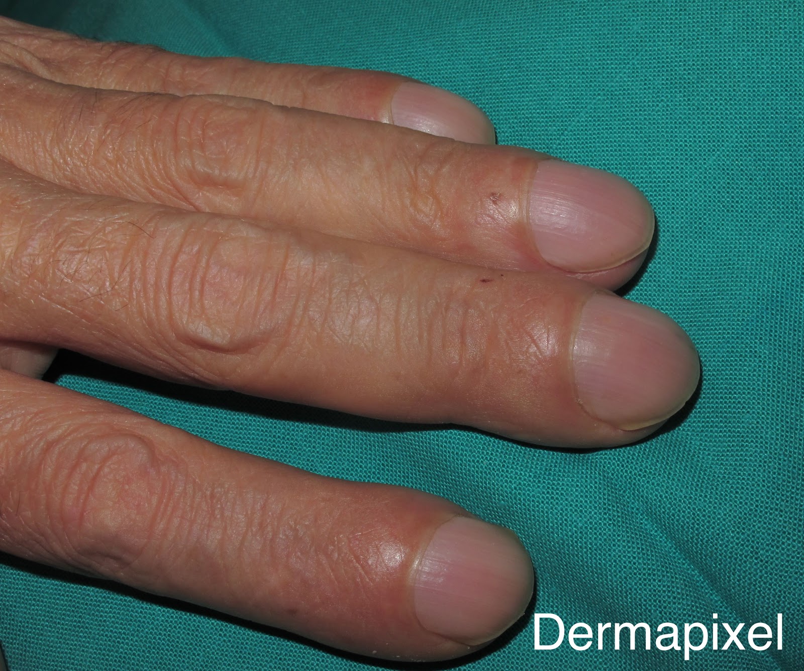 Dermapixel: abril 2018