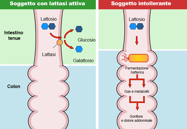 Intolleranza al lattosio. Cosa ci dice l'evoluzione?