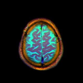 Nevit's blog: Color MRI of the Brain