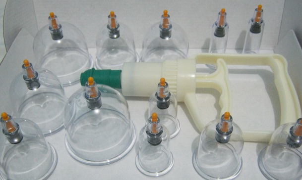 Manfaat Bekam bagi Kesehatan - Lembar Kehidupan