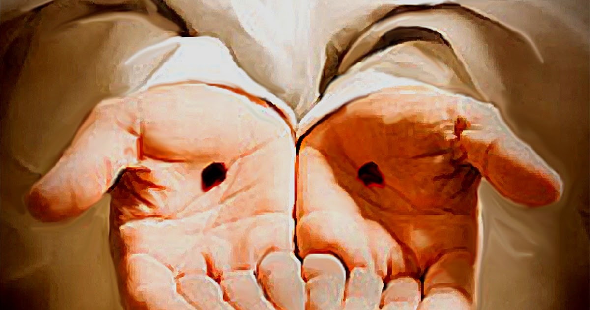 Scars of Love: Jesus's Wounds and Ours