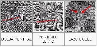 El dactilograma: B) DIFERENTES TIPOS DE DACTILOGRAMA-PATRONES