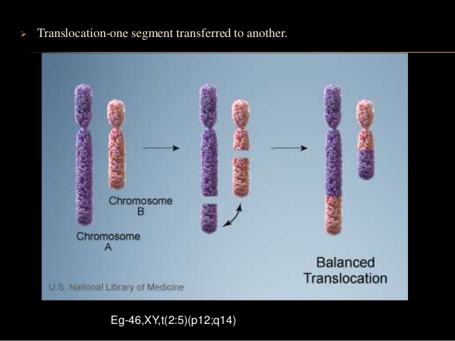 Kayli is Loving Life Trisomy Style!!!: Trisomy Awareness Day 23 ...