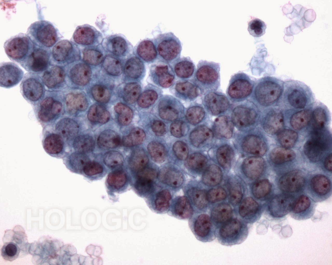 Anatomía patologica