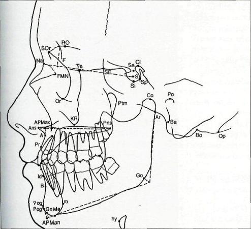 Dentistry lectures for MFDS/MJDF/NBDE/ORE: Note on Radiographic Anatomy ...