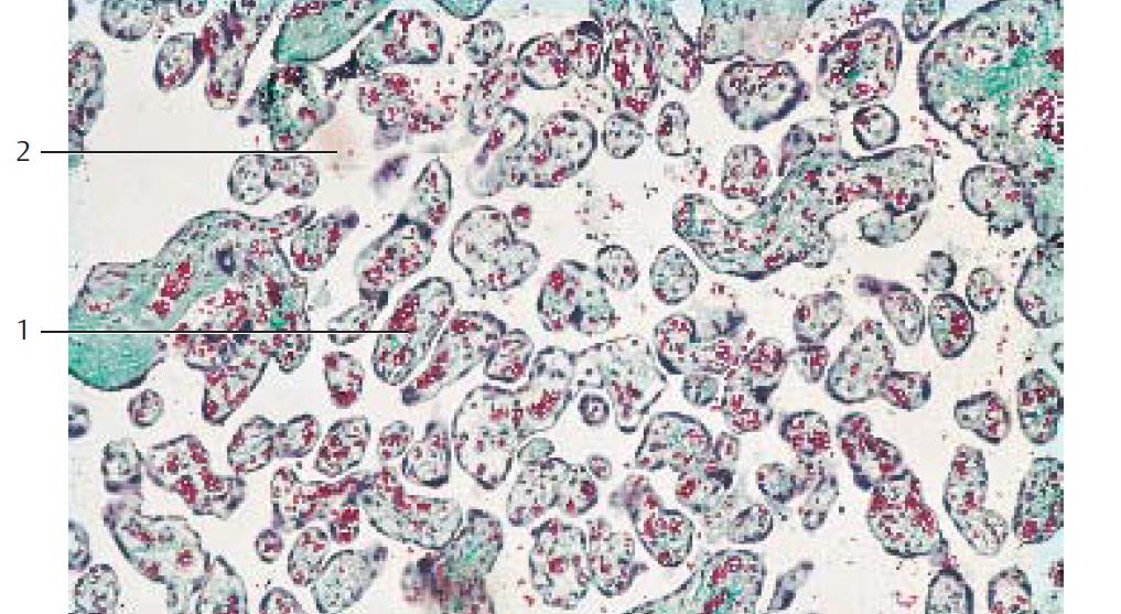 De Histology: Placenta (Histology)